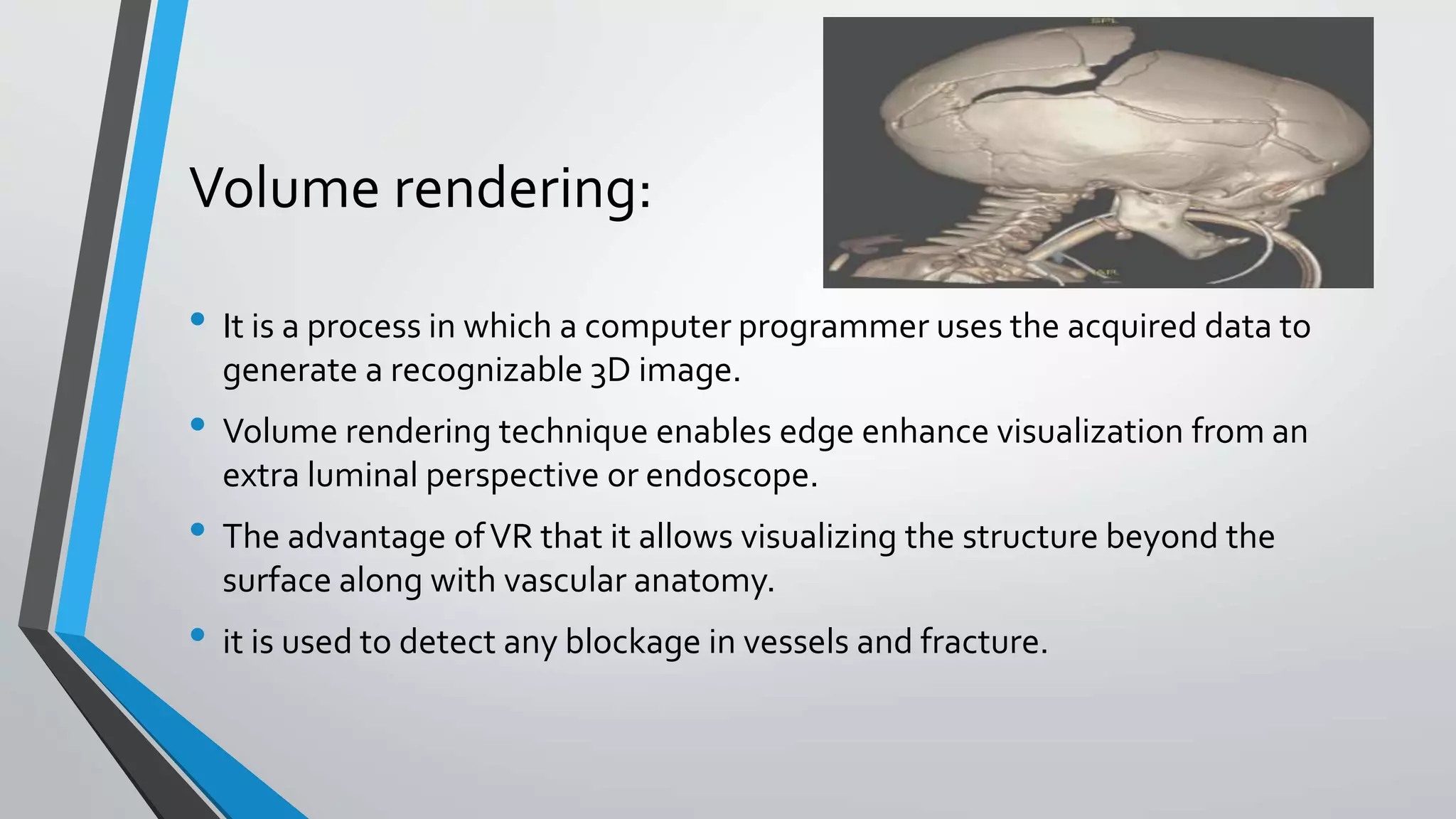 Post processing of computed tomography | PPTX