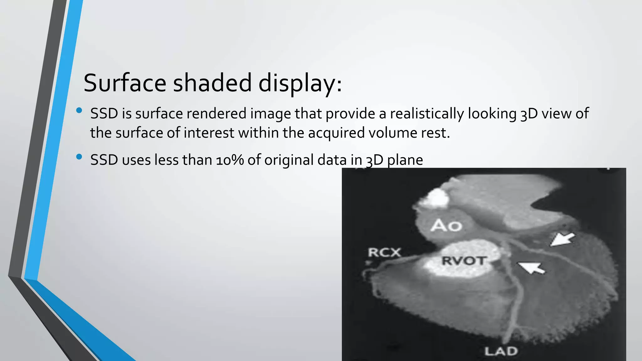 Post processing of computed tomography | PPTX