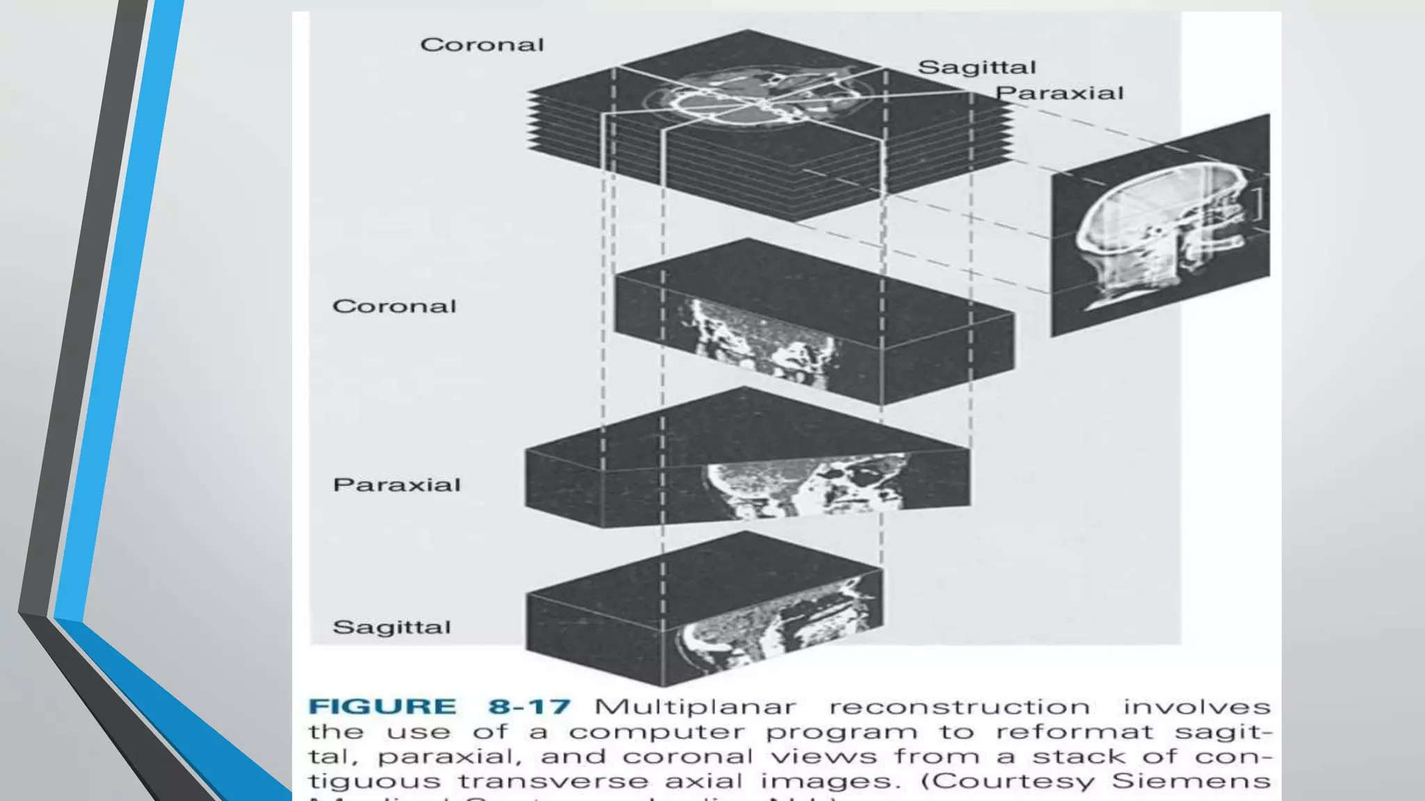 Post processing of computed tomography | PPTX