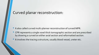 Post processing of computed tomography | PPTX