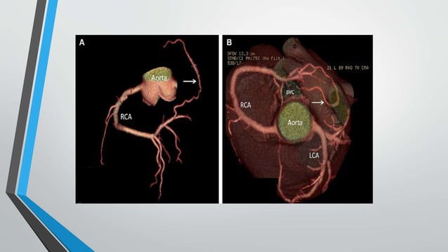 Post processing of computed tomography | PPTX