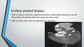 Post processing of computed tomography | PPTX