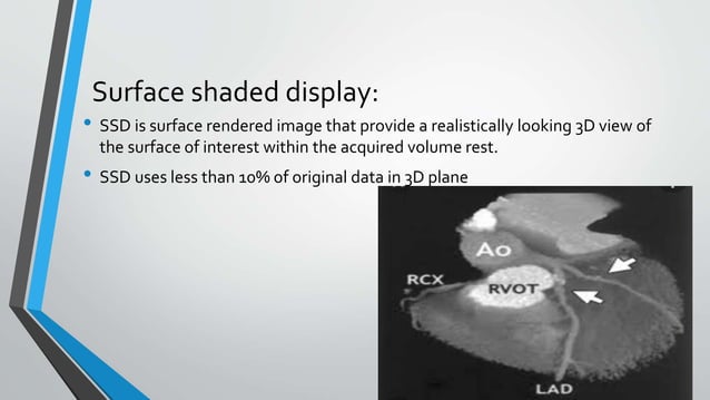 Post processing of computed tomography | PPTX