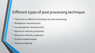 Post processing of computed tomography | PPTX