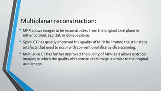 Post processing of computed tomography | PPTX