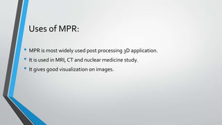 Post processing of computed tomography | PPTX