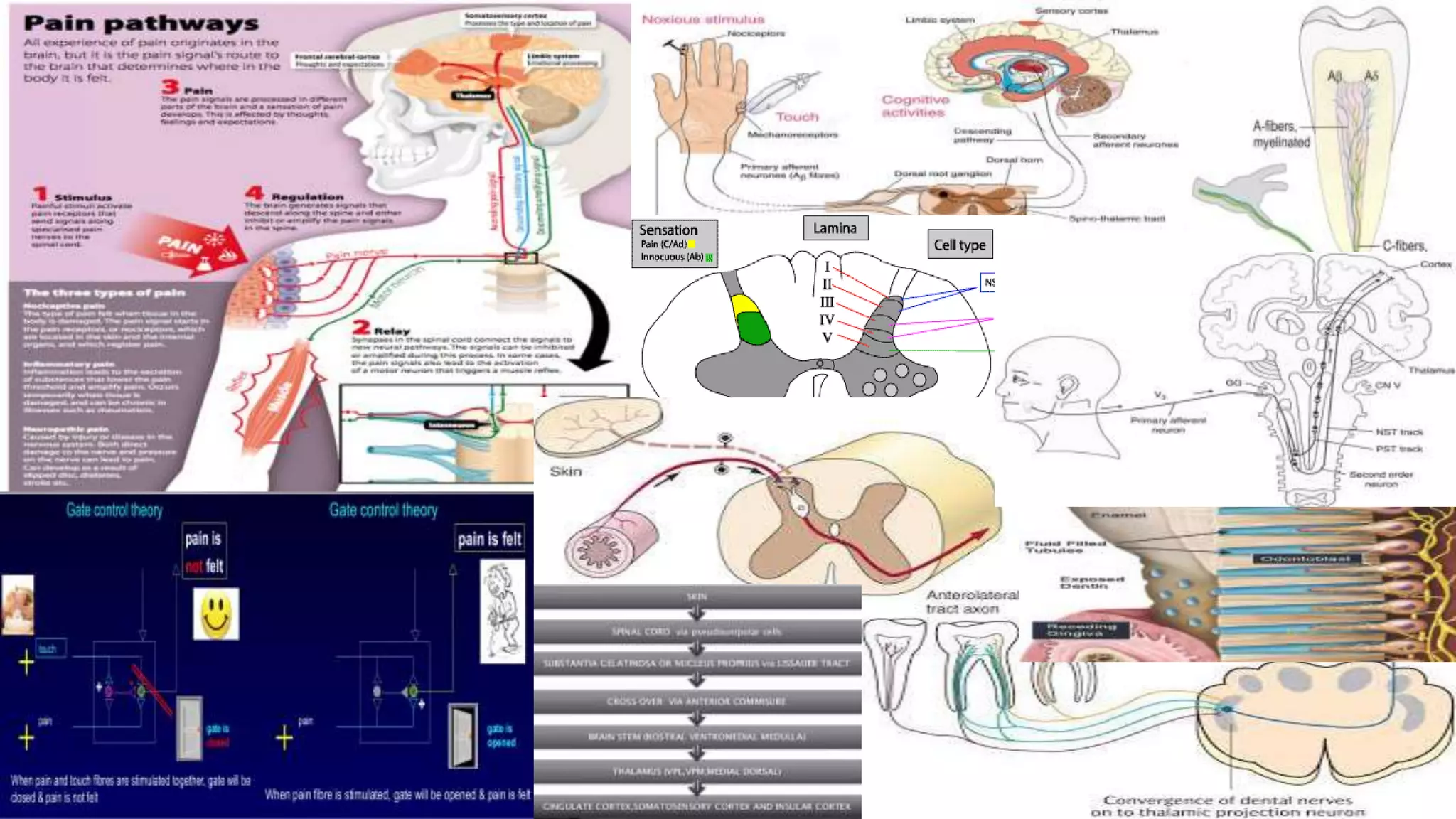 Pain Pathway- Poster | PPT