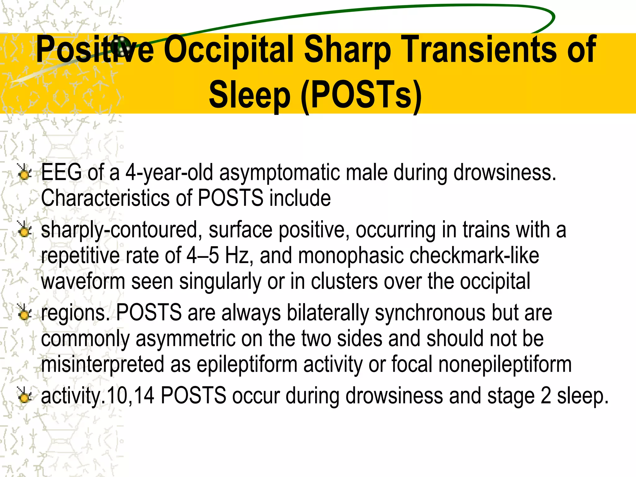 Positive Occipital Sharp Transients of Sleep, Posterior slow-wave ...