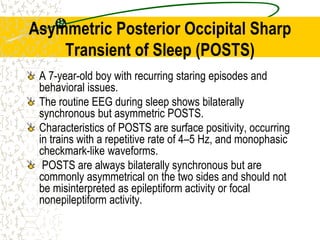 Positive Occipital Sharp Transients of Sleep, Posterior slow-wave ...