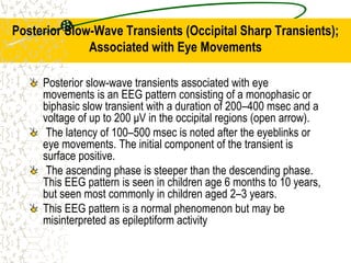 Positive Occipital Sharp Transients of Sleep, Posterior slow-wave ...