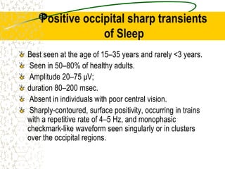 Positive Occipital Sharp Transients of Sleep, Posterior slow-wave ...