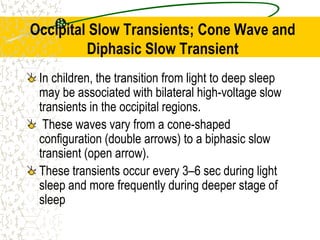 Positive Occipital Sharp Transients of Sleep, Posterior slow-wave ...
