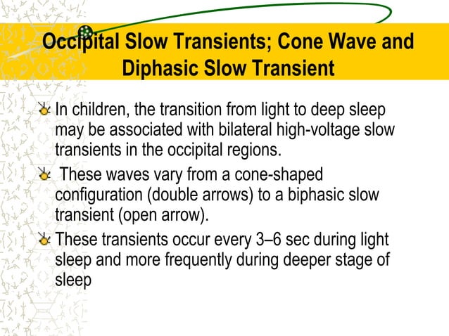 Positive Occipital Sharp Transients of Sleep, Posterior slow-wave ...