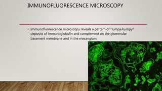 Post streptococcal glomerulonephritis | PPTX