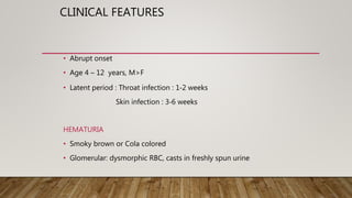 Post streptococcal glomerulonephritis | PPTX