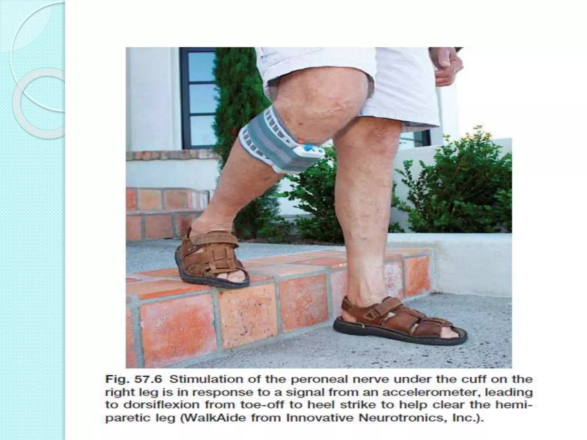 Post stroke motor rehabilitation | PPTX | Brain and Nervous System ...