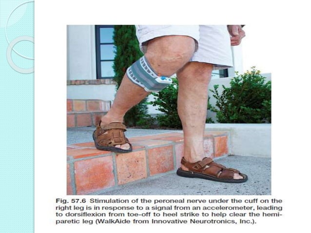 Post stroke motor rehabilitation | PPTX | Brain and Nervous System ...