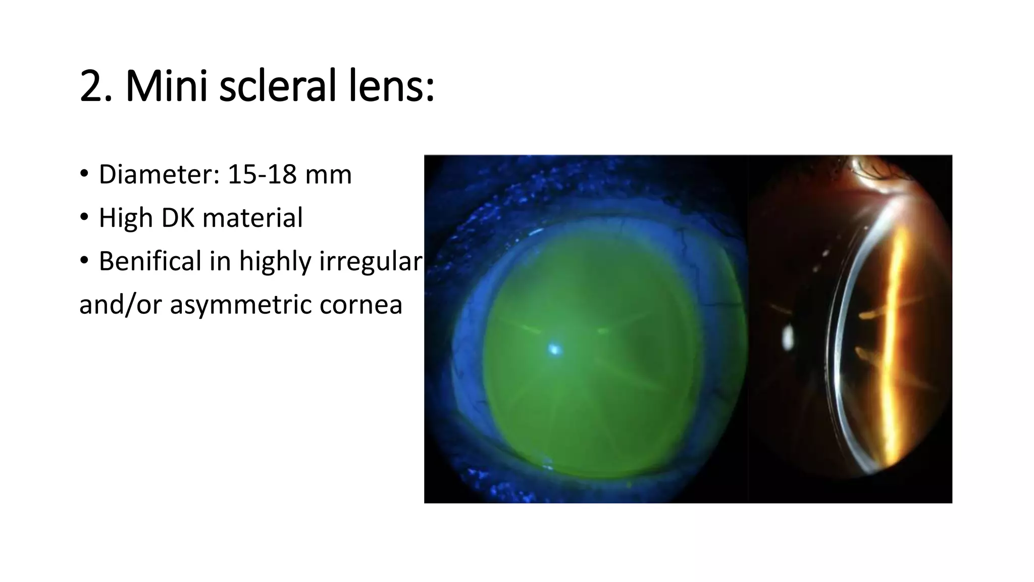 Post surgical contact lens.pptx