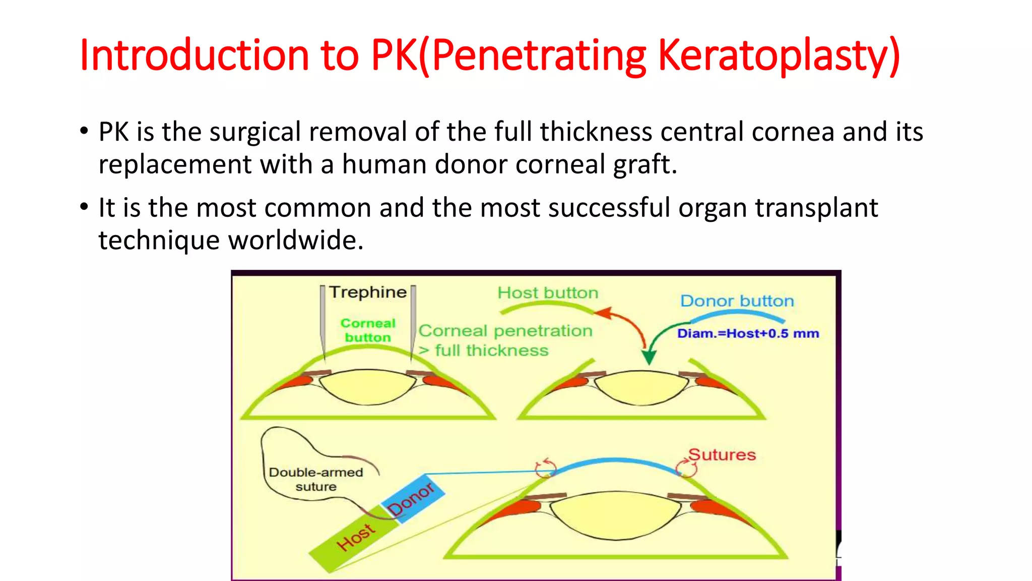 Post surgical contact lens.pptx