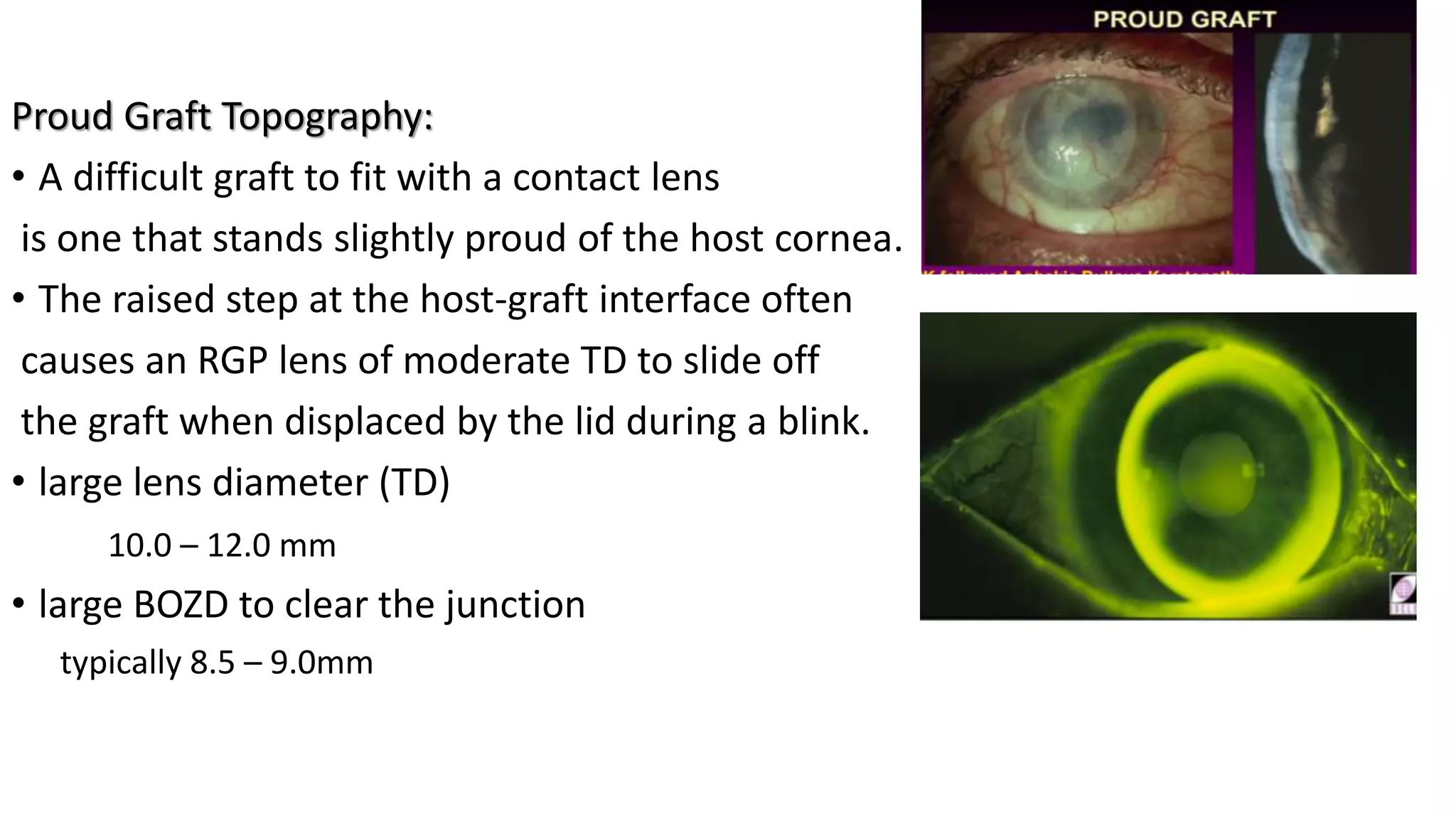 Post surgical contact lens.pptx