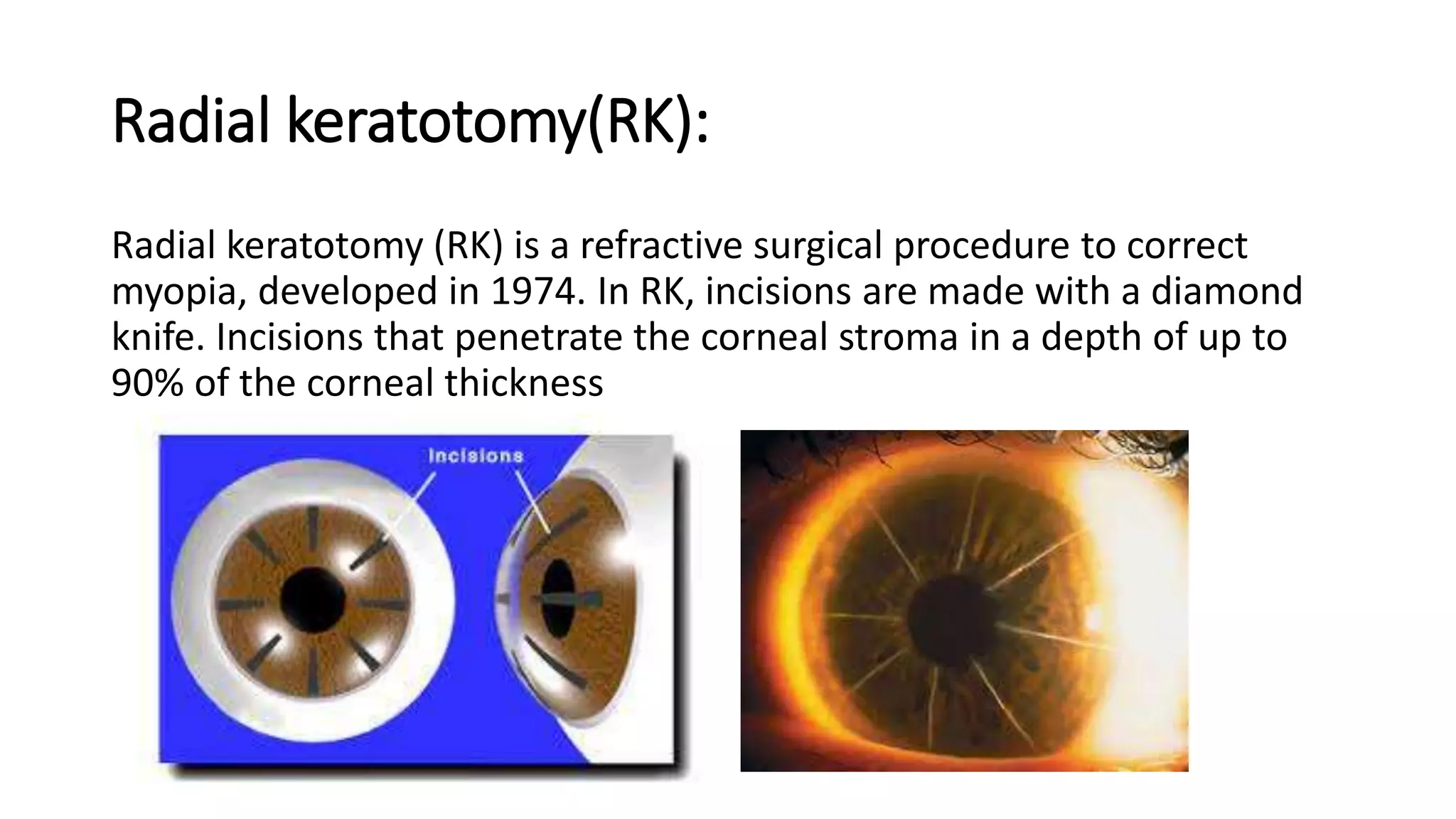 Post surgical contact lens.pptx