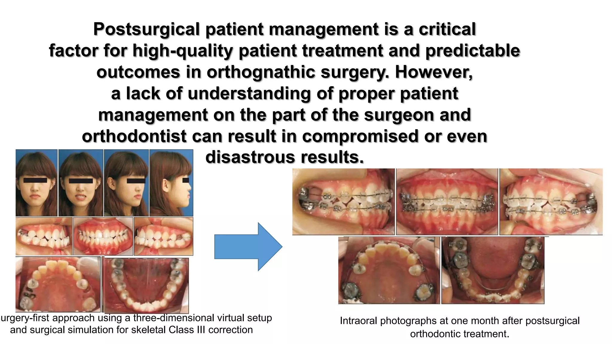 Postsurgical orthodontics | PPTX