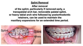 Postsurgical orthodontics | PPTX