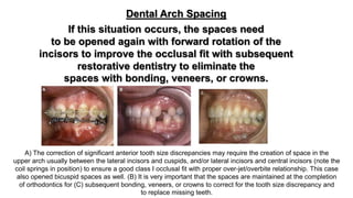 Postsurgical orthodontics | PPTX