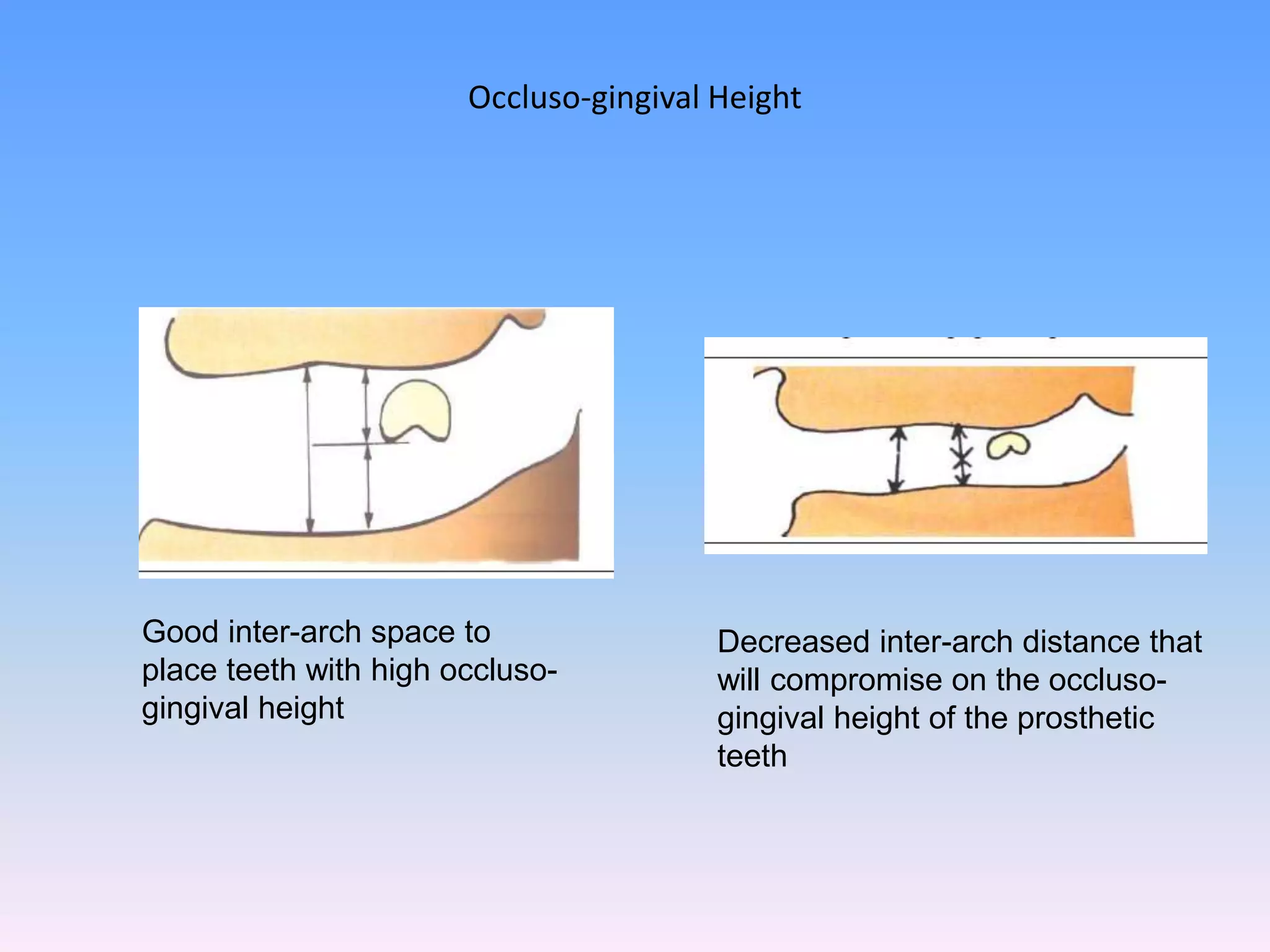 Post teeth selection | PPT