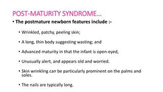 Postterm pregnancy | PPTX