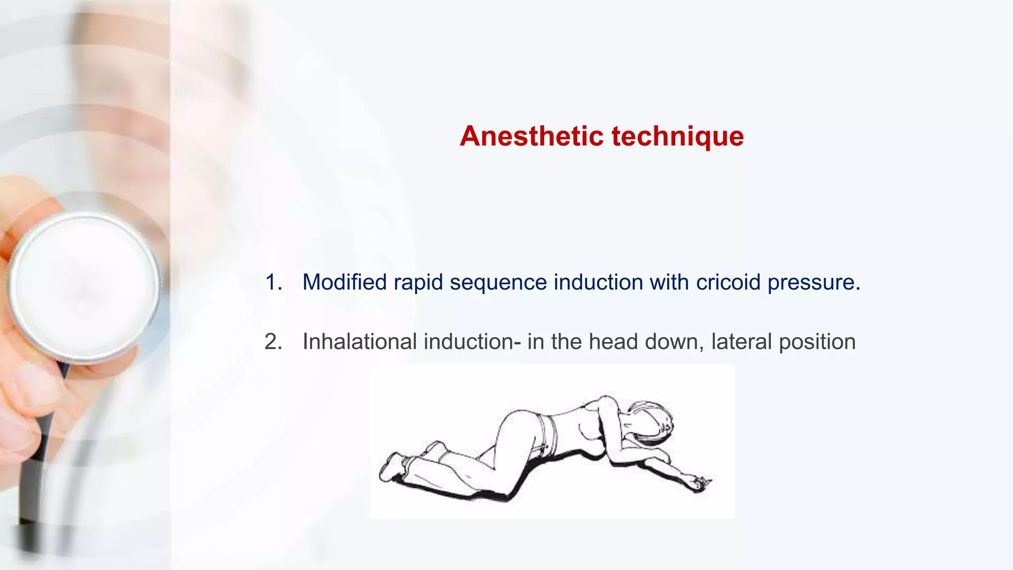 Post tonsillectomy bleed & anesthesia considerations | PPTX