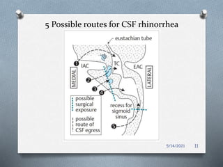 Post traumatic csf leak & bsf mgt update finalllpptx | PPTX | Death ...