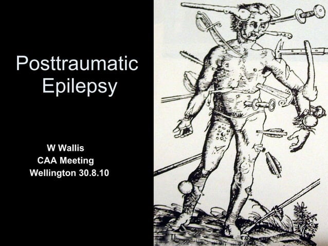 Lecture on post traumatic epilepsy | PPT