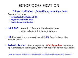 Post traumatic myositis ossificans dr. k. prashanth | PPTX