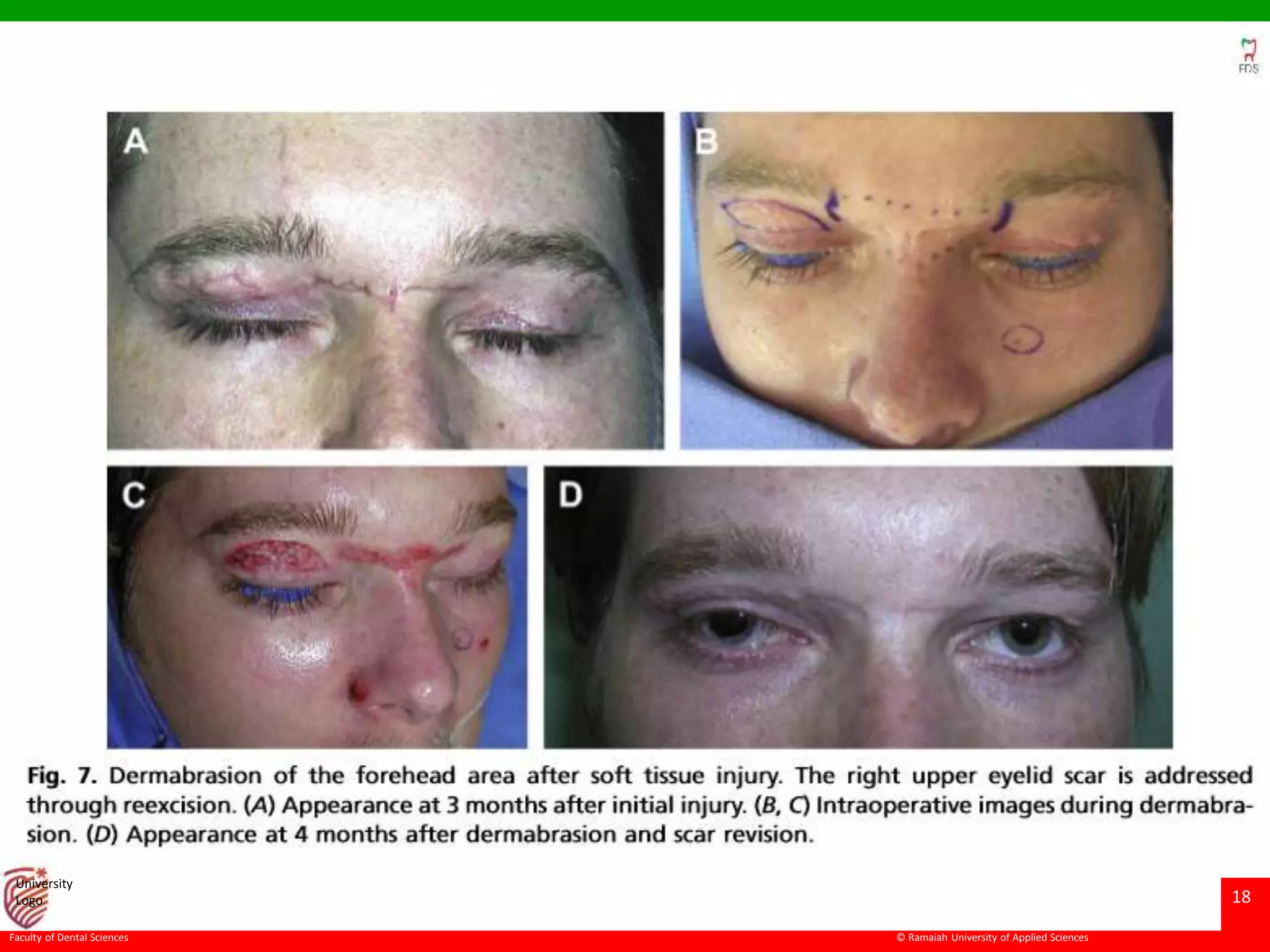 Post traumatic residual deformities | PPTX