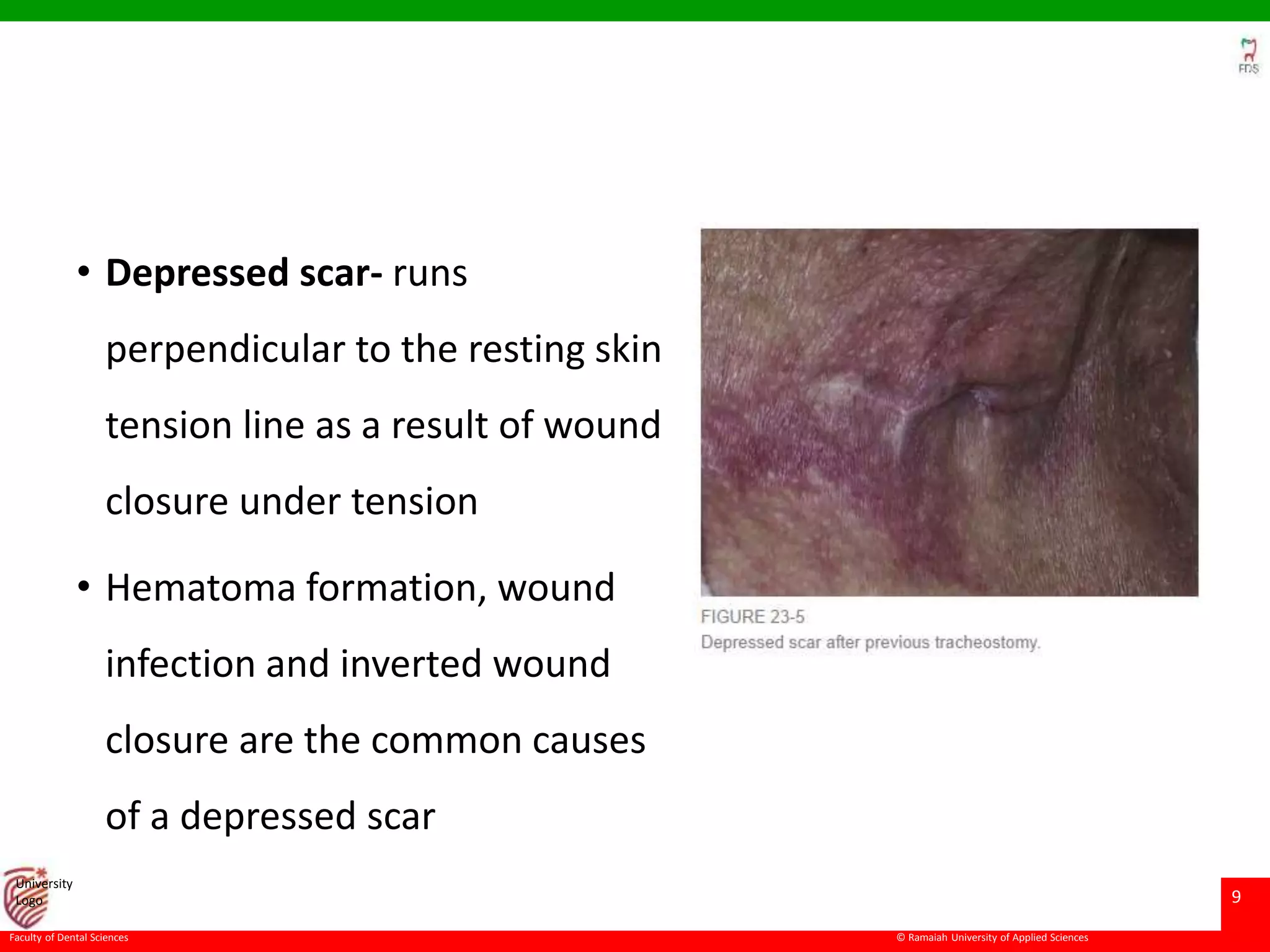 Post traumatic residual deformities | PPTX