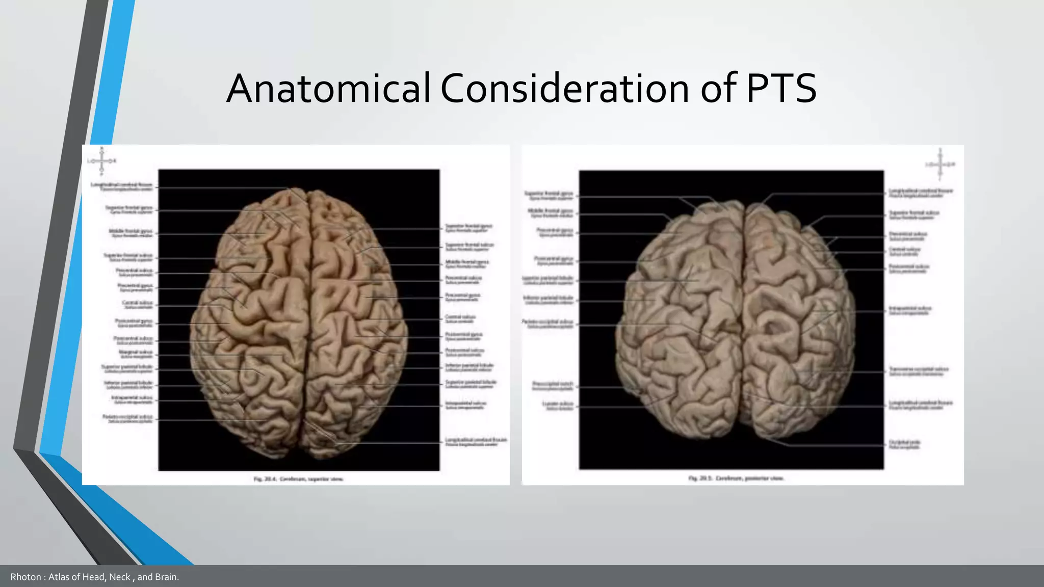 Post Traumatic Seizure - Syah reza manefo.pptx