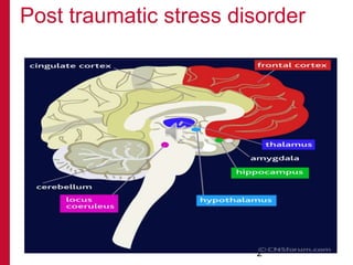 Post traumatic stress disorder | PPTX | Brain and Nervous System ...