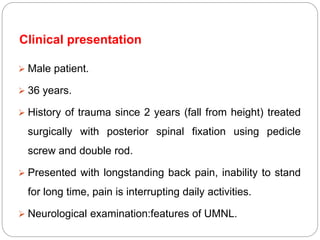 posttraumatic kyphosis ppt -D12 الجمعية.pptx | Physical Therapy | Wellness