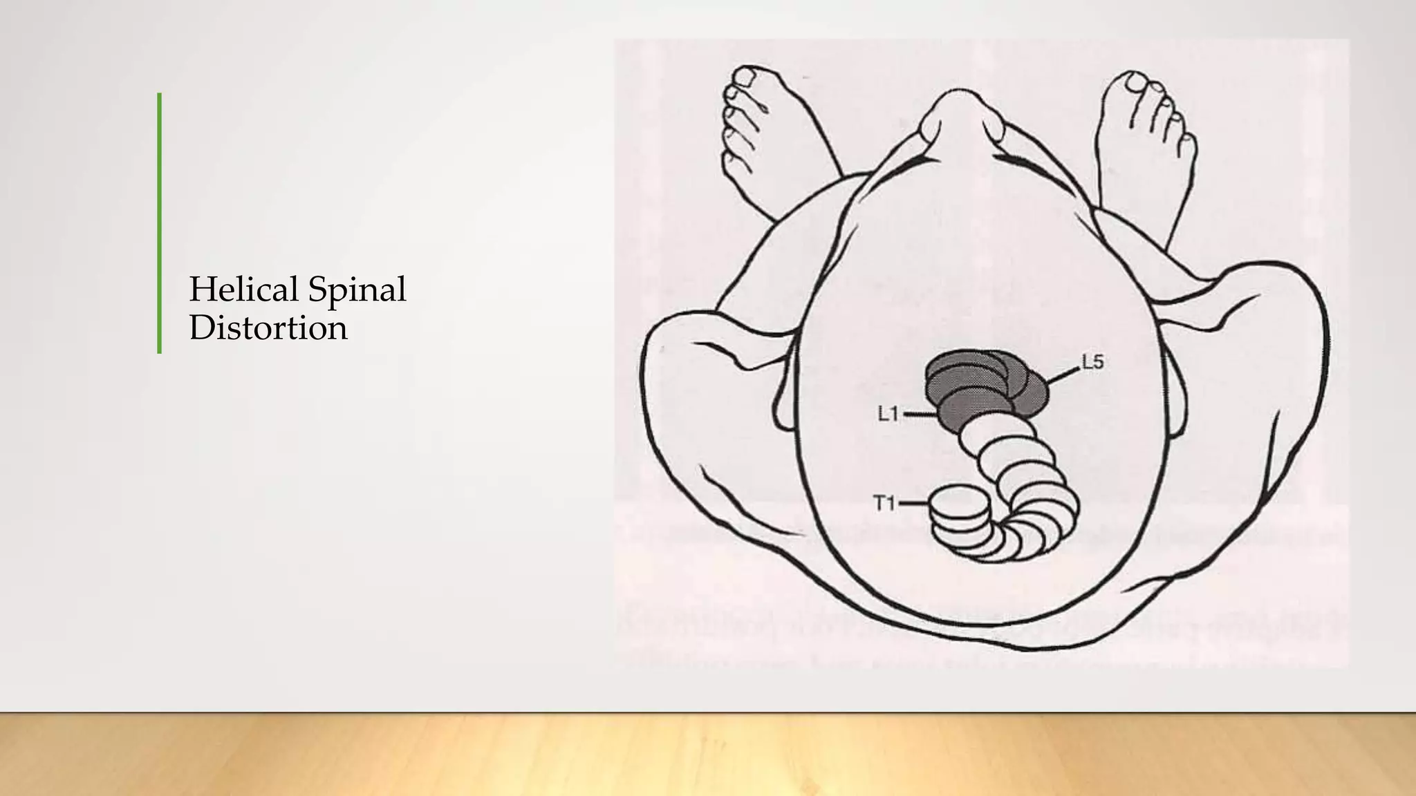 Postural Analysis .ppt