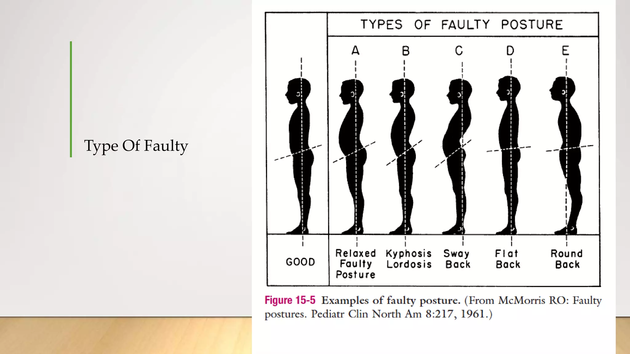 Postural Analysis .ppt