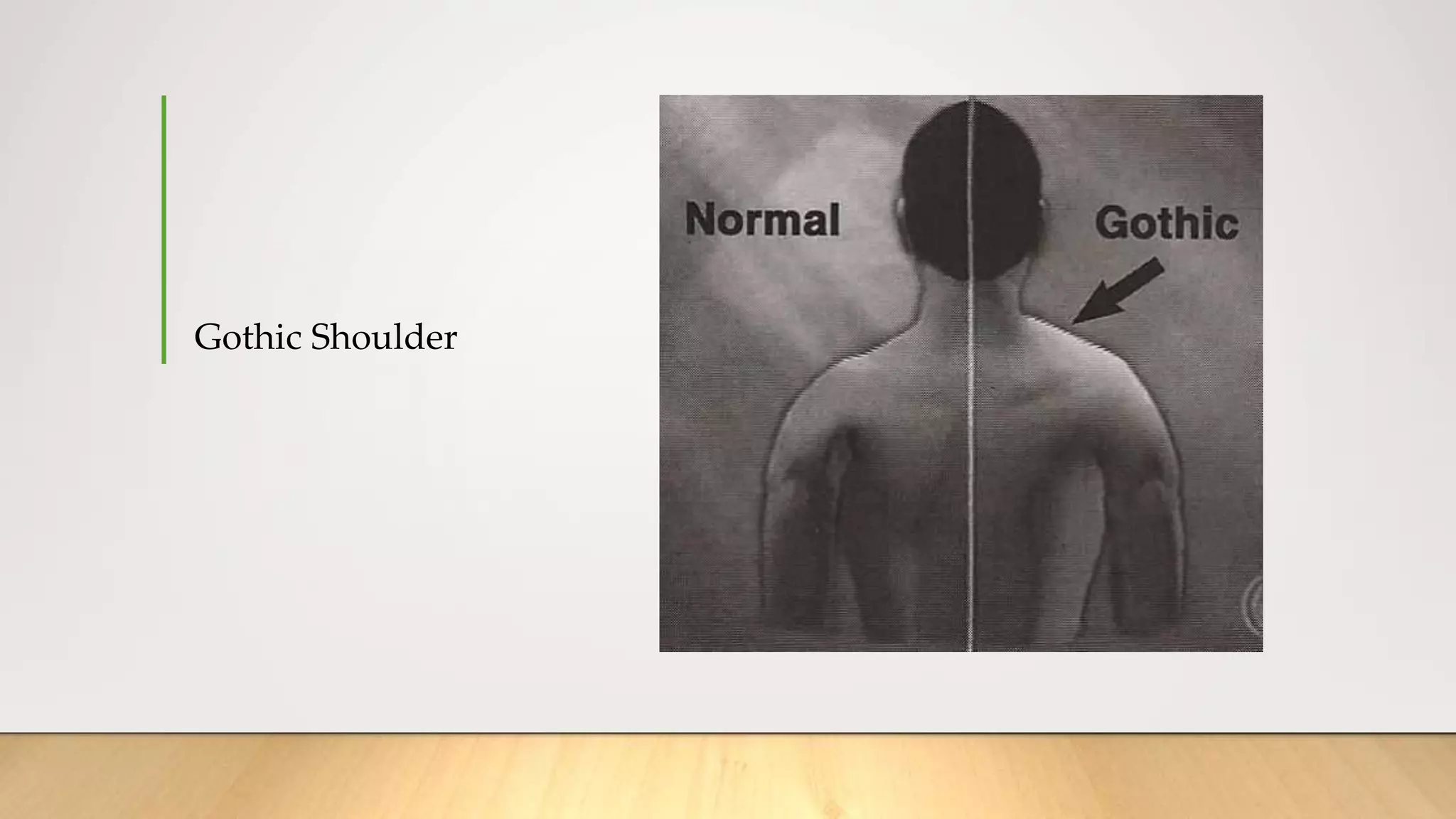 Postural Analysis .ppt
