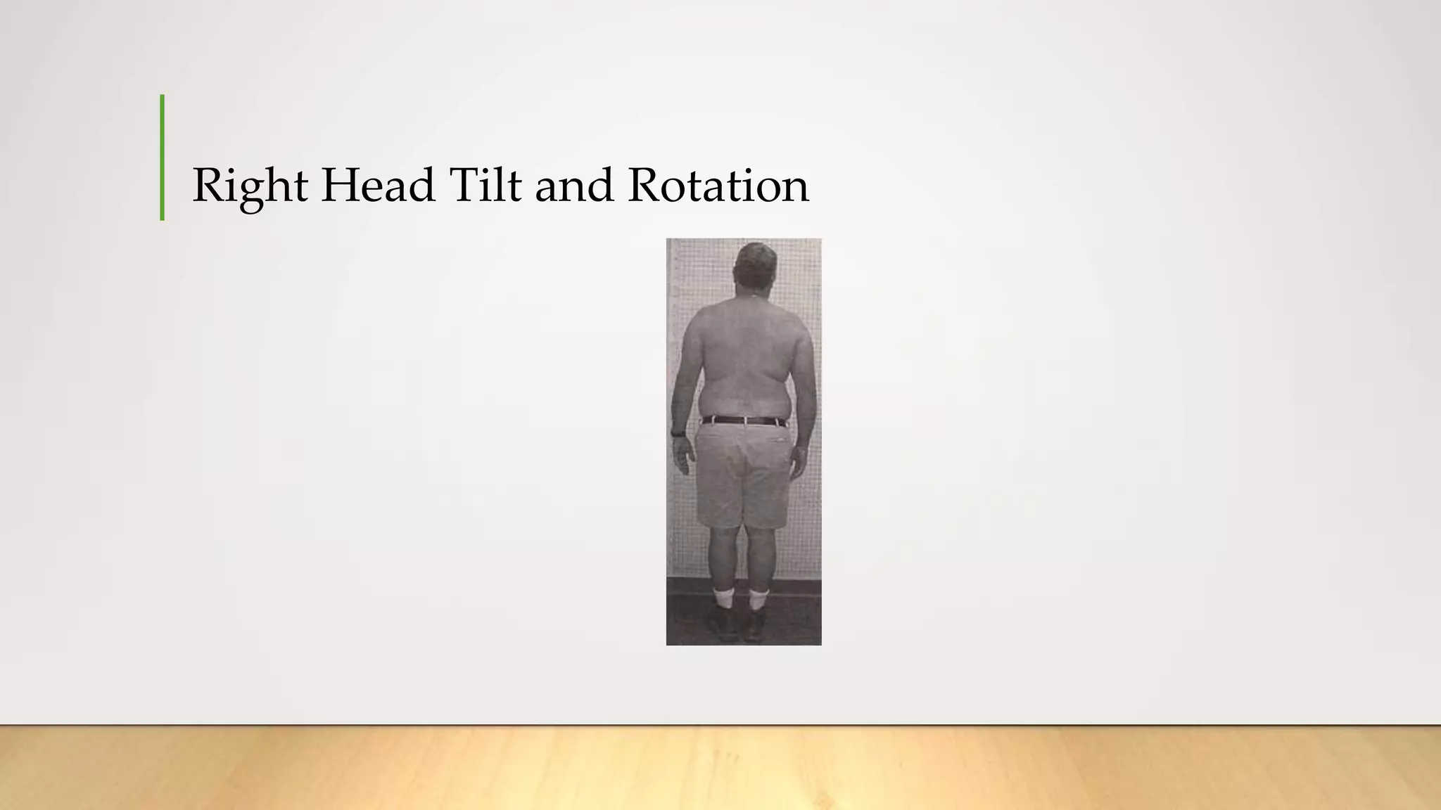 Postural Analysis .ppt