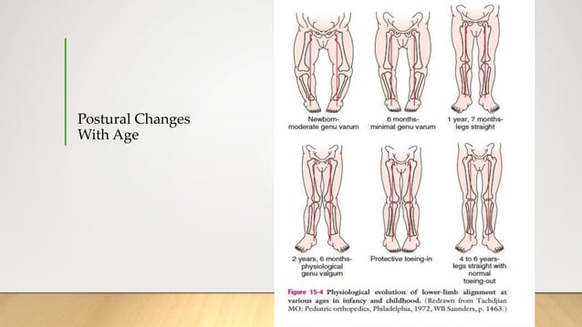 Postural Analysis .ppt