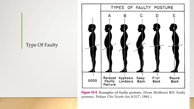 Postural Analysis .ppt