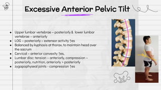 Postural deviation in different planes.pptx