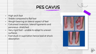 Postural deviation in different planes.pptx