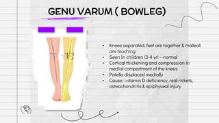 Postural deviation in different planes.pptx