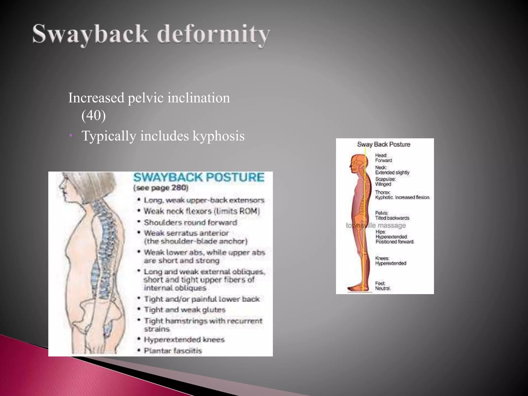 Postural deviations | PPTX