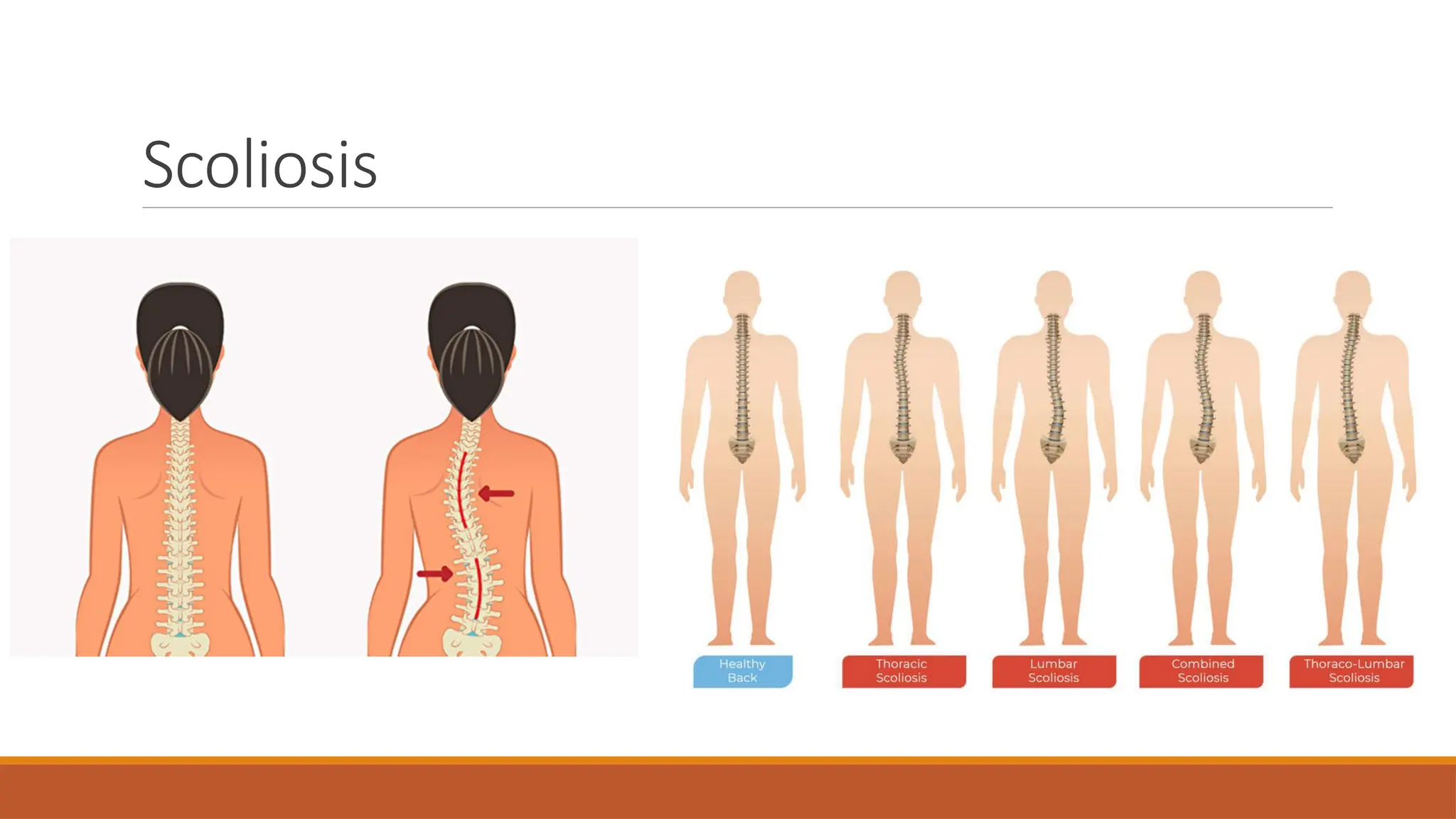 Impaired Postural Deviations In Human Body.pptx